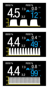 Gas Sampling Lines | bluepoint MEDICAL