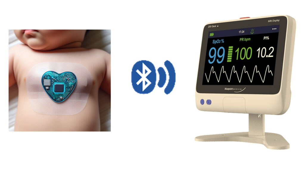 NEOPATCH | MRI-compatible monitor | bluepoint MEDICAL